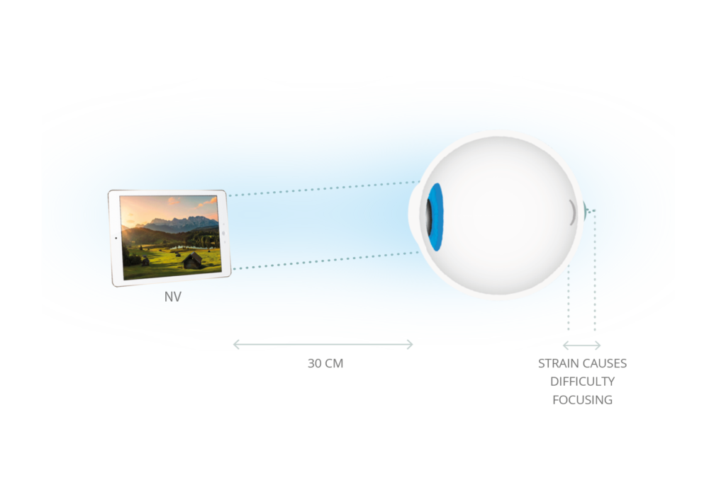Millenials: A solution for the hyperconnected generation | Horizons Optical