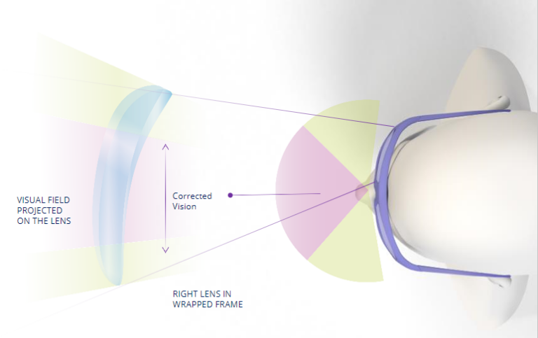 THE BEST SOLUTION FOR WRAP FRAMES WITH PRESCRIPTION - Horizons Optical